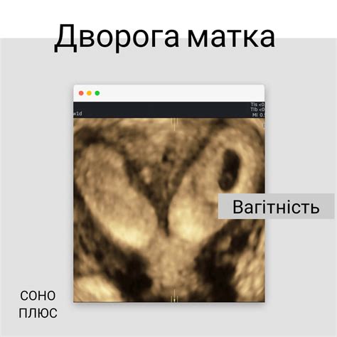 Аномалії будови матки