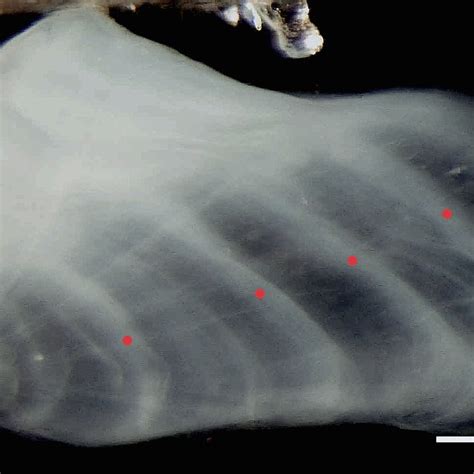 Photomicrograph Of Otolith Cross Section From A 49 Cm 5 Year Old Download Scientific Diagram