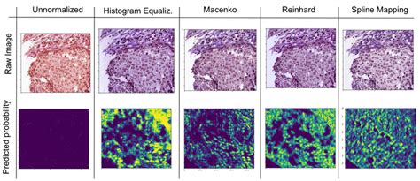 Comparison Of Different Stain Normalization Procedures On Model
