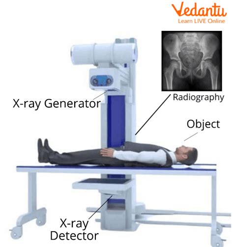 X Ray Equipment Ppt At Henry Soler Blog