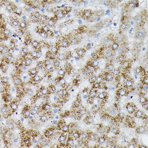 Pi 3 Kinase Catalytic Subunit Alpha Pik3ca Antibody A12585