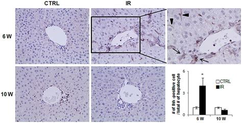 Ihc For Ihh In The Liver At 6 And 10 Weeks Post Radiation Brown Color