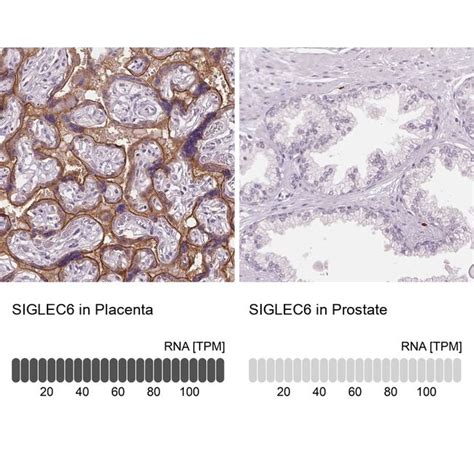 Siglec6 Polyclonal Antibody Invitrogen 100 μl Unconjugated Antibodies