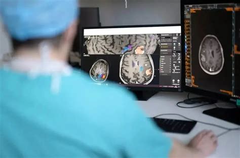 این هوش مصنوعی در ۱۰ ثانیه بخش‌های باقی‌مانده از تومور مغزی را حین