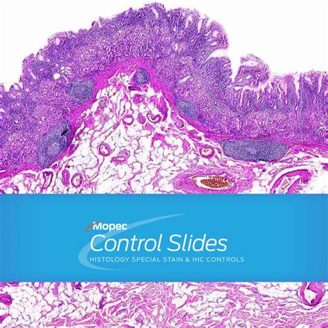 Anatomic Pathology Consumables Mopec
