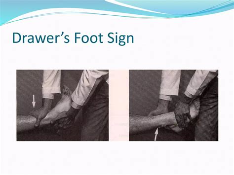 Ankleassessment 180926221008 1pdf