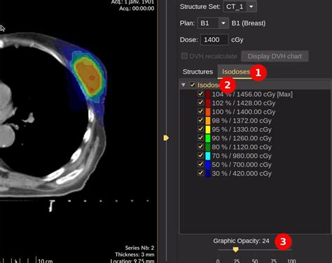 dicom rt tools weasis documentation