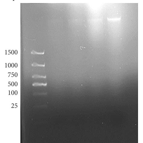 Activity Tests And Tagmentation Demonstrated With The Tn5 Transposase Download Scientific