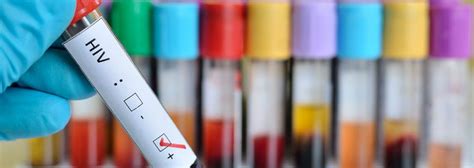 Hiv Lab Tests Positive Peers