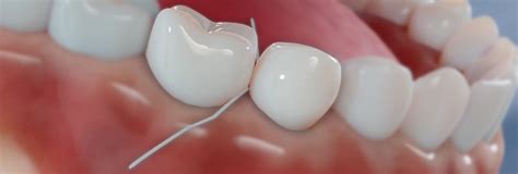 Beyond Brushing How To Floss With Proper Technique Meyerwood Dentistry Beyond Brushing How To Floss With Proper Technique Meyerwood Dentistry