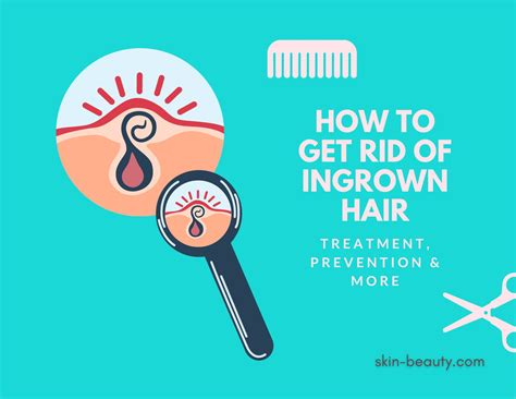Ingrown Female Pubic Hair Causes Treatment And Prevention