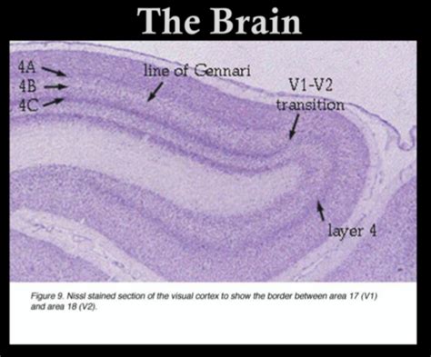 Vs Lecture 15 The Constructive Nature Of Visual Processing Flashcards Quizlet
