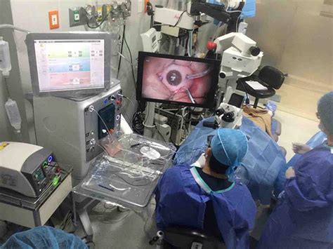 Eva Vitrectomy System For Dorc On Behance