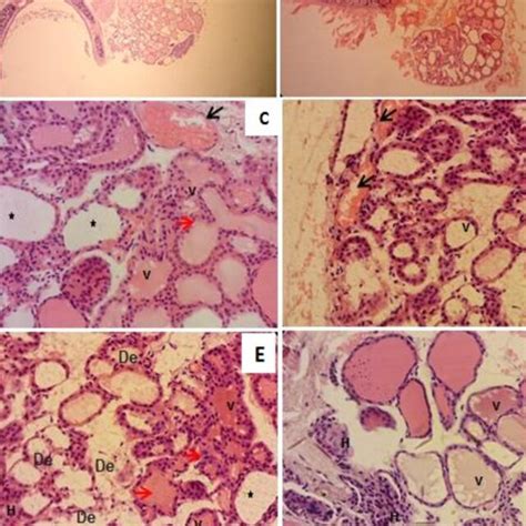 Sections Of The Thyroid Gland Of Indoxacarbtreated Group Of Mice Show