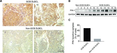Pin 1 Expression Is Enhanced In The Gcb Subtype Of Dlbcl A Download Scientific Diagram