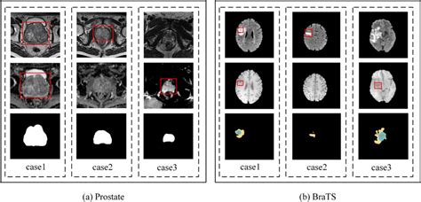 Samples Of Single Modal And Multi Modal Images A T2 Weighted Images