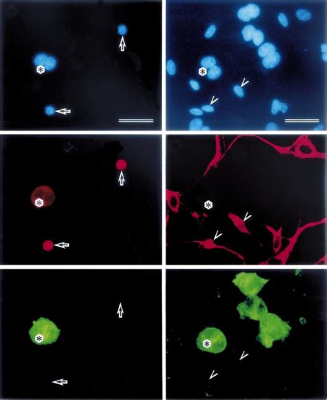 Dilichos Biflorus Agglutinin Dba Staining Of Epithelial Cells And