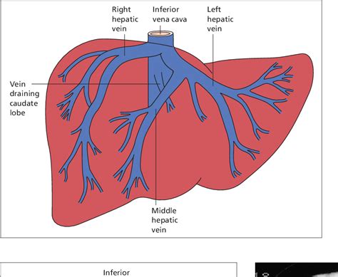 Hepatic Vein