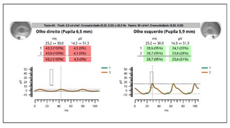 Erg Based Risk Assessment In Crvo Lkc Technologies