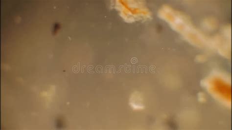 Exploring The Hidden Beauty Of Microscopic Life In Ambient Motion Stock Video Video Of Cycles