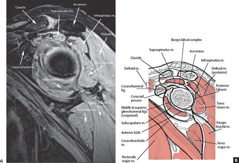 Shoulder Anatomy Mri Shoulder Mr Arthrogram E Anatomy