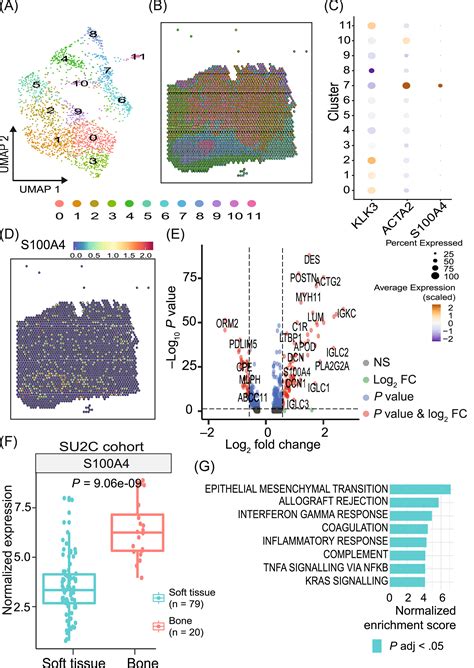 Spatial Whole Transcriptome Profiling Of Primary Tumor From Patients