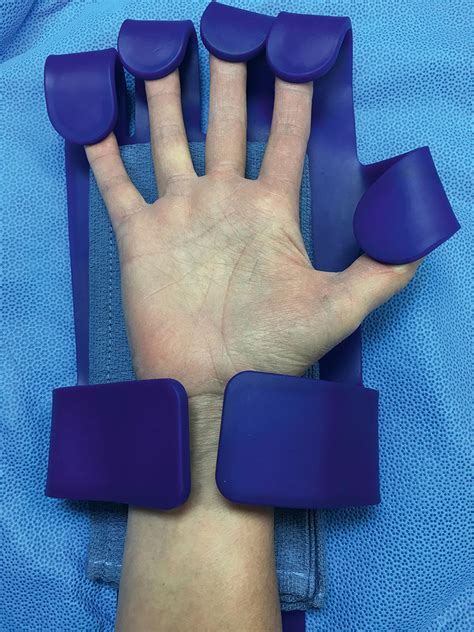 Basic Surgical Technique And Postoperative Care Clinical Tree