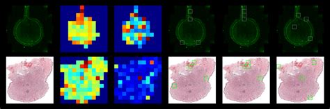 Visualization Of Attention Weights And Patch Selection Under Different Download Scientific