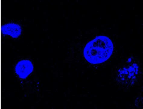 Why Cell Size Increases After Transfection With Lipofectamine 2000 Researchgate