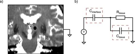 1 Principle Sketch Of The Volume Conductor Model A Visualization Of