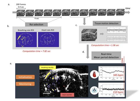 Physio Fus Using Fus Imaging Data To Monitor Breathing And Heart Rate