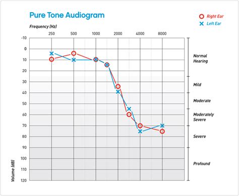 Cara Membaca Audiogram Serta Pengertian Audiogram Brilliant Hearing