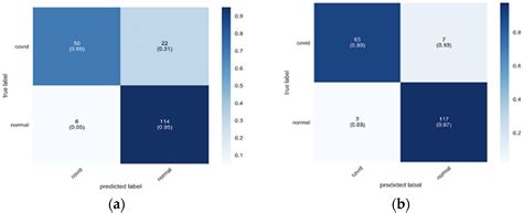 Comprehensive Survey Of Machine Learning Systems For COVID Detection