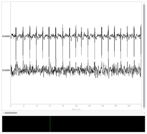 Repairing Artifacts With Ica — Mne 1 0 3 Documentation