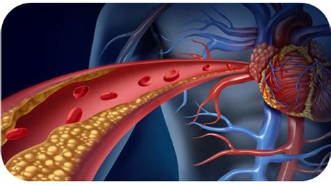 الاستماع منهاجي