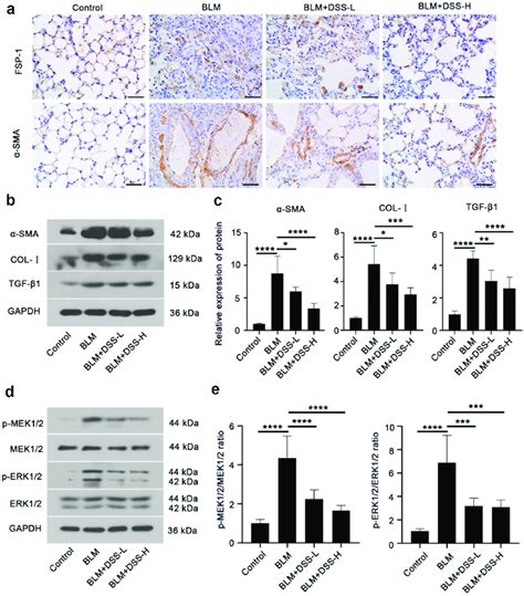 DSS Inhibited Fibroblast Myofibroblast Differentiation Via Inhibiting Download Scientific