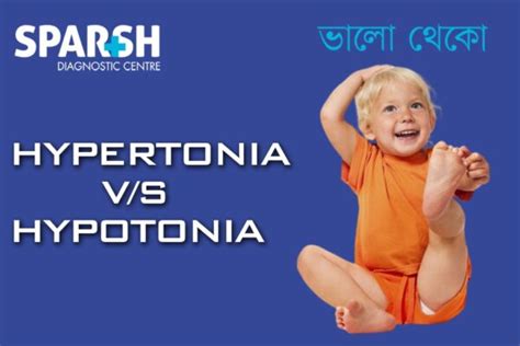 Hypertonia Vs Hypotonia Sparsh Diagnostic Center