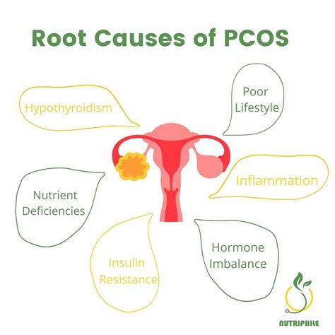 Nutriphile 🎗️ Root Causes Of Pcos High Insulin Levels Stimulate The Ovaries To Produce