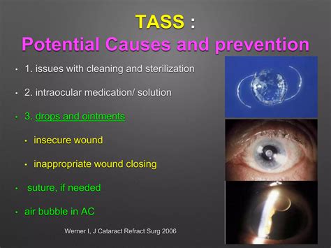 Tass Vs Endophthalmitis Pptx