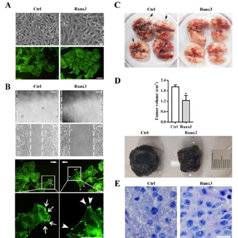 runt related transcription factor 3 runx3 re expression in b16 f10