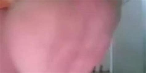 Rak Amputee Showing Off Stump Tnaflix Com