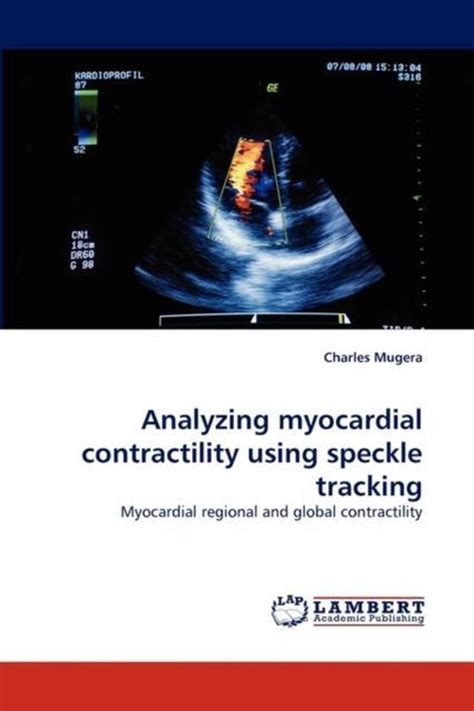 Analyzing Myocardial Contractility Using Speckle Tracking 9783843370769 Charles Bol