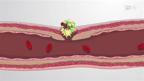 Video Clot Retraction And Fibrinolysis