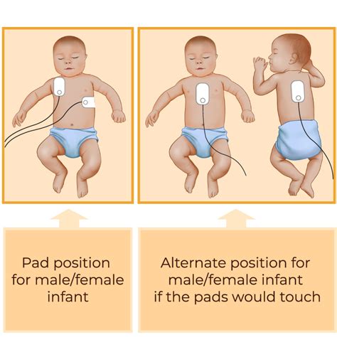 How Cpr Is Performed On Infants