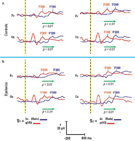 Visualauditory And Orthographicphonological Speed Of Processing In