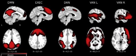 E Task Positive And Task Negative Networks For All Groups As Revealed