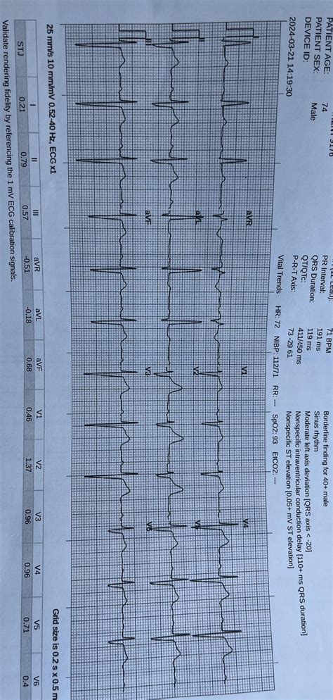 Near Sycopal Episode Could Use Some Feed Back Rekgs