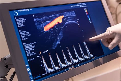 Imperial Centre Of Excellence In Vasculitis Research Vasculitis Uk