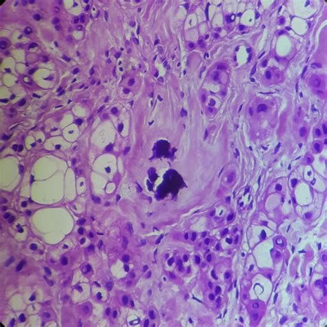 Bashar Abdullah Professor Professor Phd Oral Pathology Research