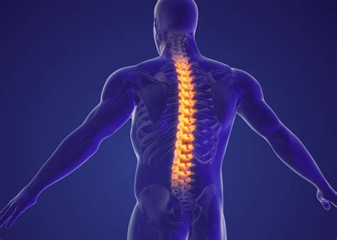 Spinal Fusion Dr Vineet Agrawal